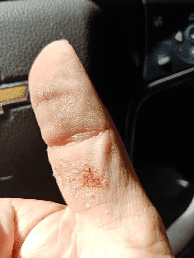 Largemouth Bass Anatomy: What You Need to Know - USAngler