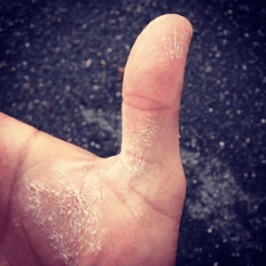 Do Fish Bite? - All You Need To Know For The Most Common Species - USAngler