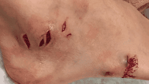 Do Fish Bite? - All You Need To Know For The Most Common Species - USAngler